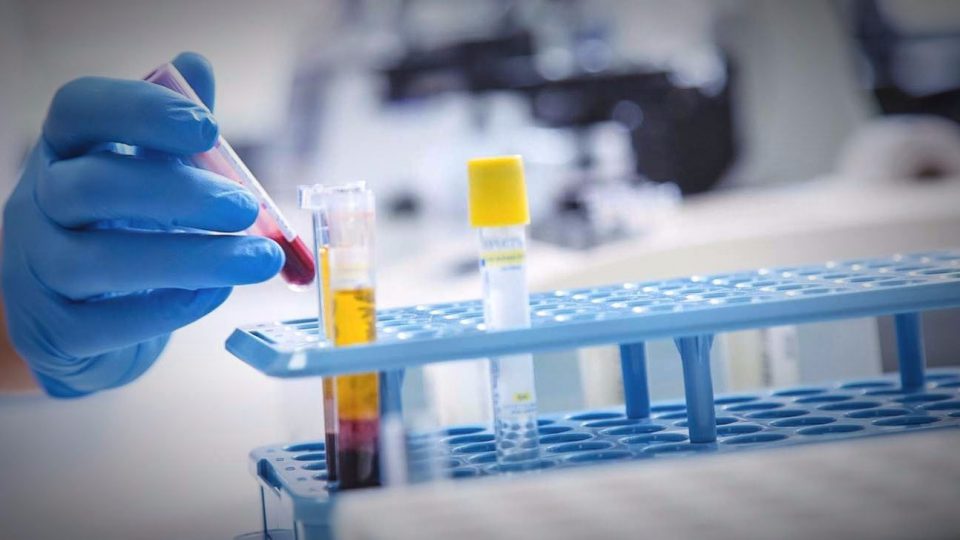 Non-invasive Blood Test Could Detect Early Cancer · Giving Compass